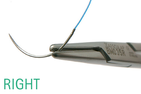 Surgical Instruments: best practices